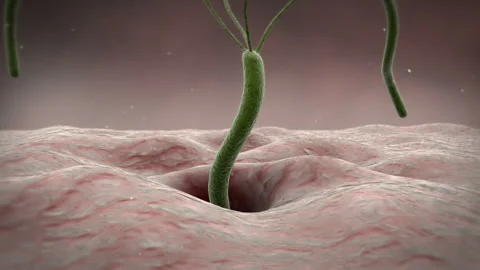 Helicobacter Pylori Stock Video Footage | Royalty Free Helicobacter ...