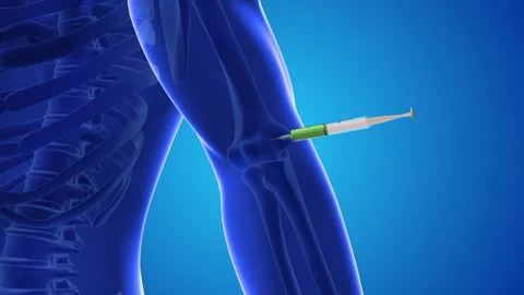 An animation shows stem cells being inje... | Stock Video | Pond5