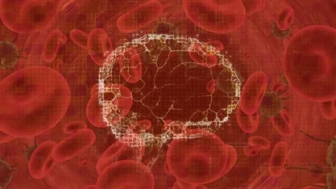 Animation of spinning human brain over m... | Stock Video | Pond5