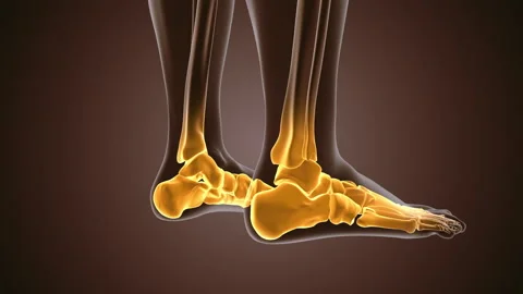 Ankle pain animation | Stock Video | Pond5