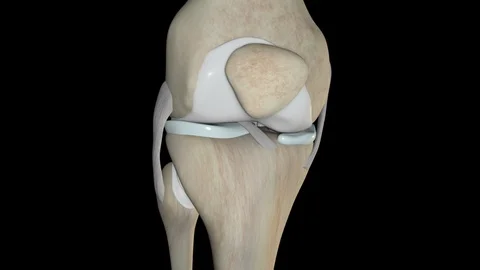 Anterior Cruciate Ligament Rupture | Stock Video | Pond5