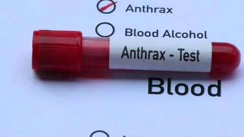 Anthrax test to look for abnormalities f... | Stock Video | Pond5