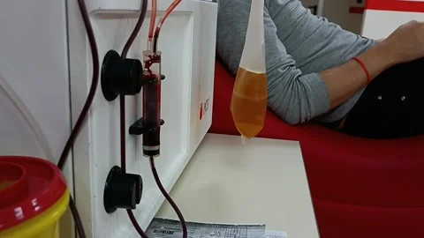 Apheresis machine to extract plasma and ... | Stock Video | Pond5