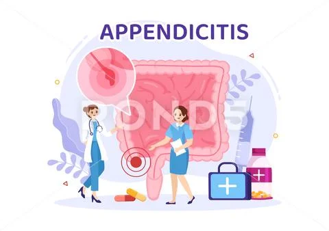 Appendicitis Illustration with Inflammation of the Appendix and Stomach Tre.. ~ Clip Art #236681571