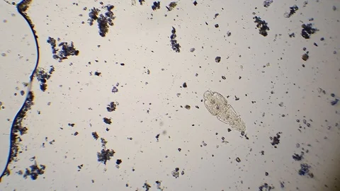 Aquatic creature under microscope | Stock Video | Pond5