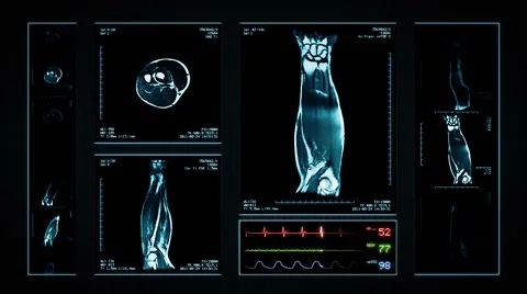 Arm Mri Scan Stock Footage ~ Royalty Free Stock Videos | Pond5