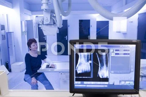 Arm, x-ray examination Hospital. Conventional radiography of the arm ...