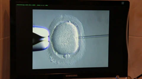 Artificial insemination - implementation... | Stock Video | Pond5