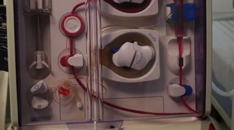 Artificial kidney (dialysis) medical dev... | Stock Video | Pond5