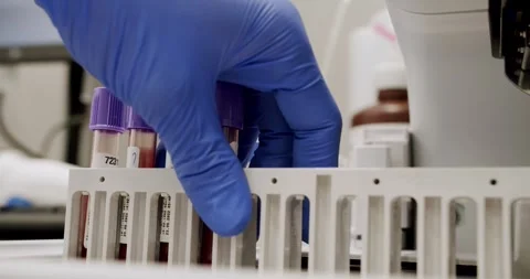 Automated machine in work process, blood... | Stock Video | Pond5