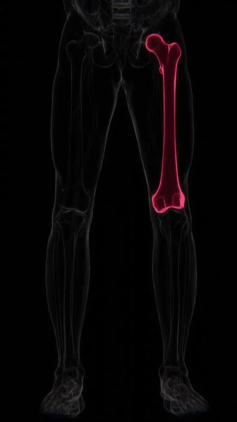 Avulsion Fracture in Vertical HQ Video |... | Stock Video | Pond5