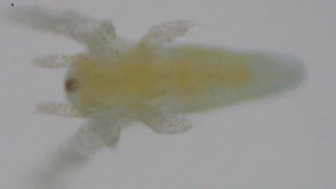 Baby of brine shrimp under microscope. T... | Stock Video | Pond5