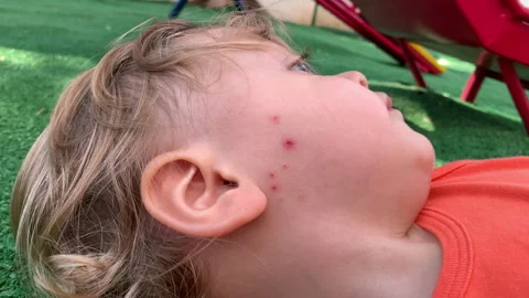 After Bites Stock Videos – Royalty-Free HD & 4K Videos | Pond5