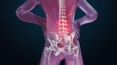 Back Pain Animation | Stock Video | Pond5