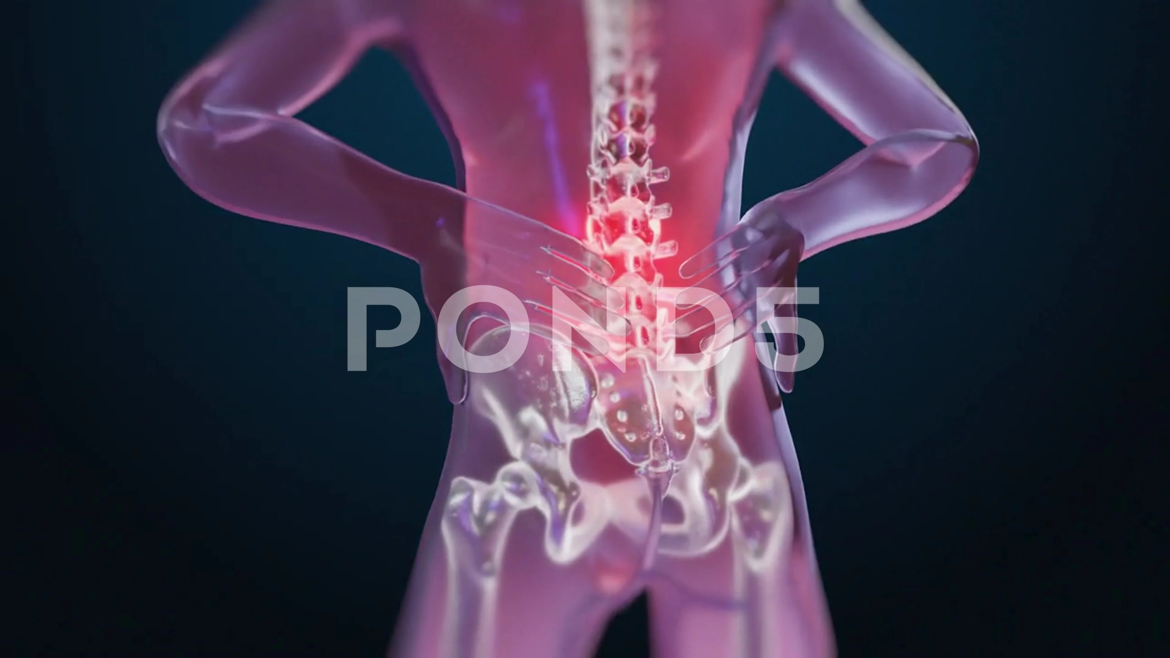 Back Pain Animation