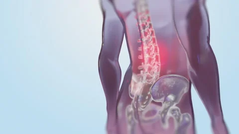 Back Pain Animation Stock Videos – Royalty-Free HD & 4K Videos | Pond5