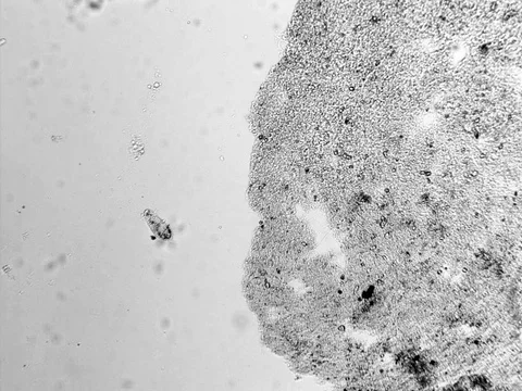 Bacteria and protozoa under the microsco... | Stock Video | Pond5