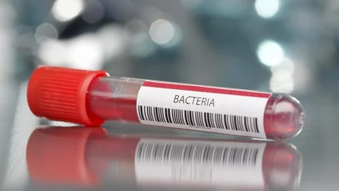 Bacteria antibody vial in medical lab | Stock Video | Pond5