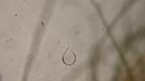 Bacteria Parasites and Worms in drinking... | Stock Video | Pond5