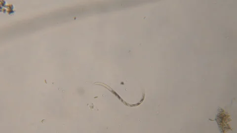 Bacteria Parasites and Worms in drinking... | Stock Video | Pond5