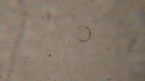 Bacteria Parasites and Worms in drinking... | Stock Video | Pond5
