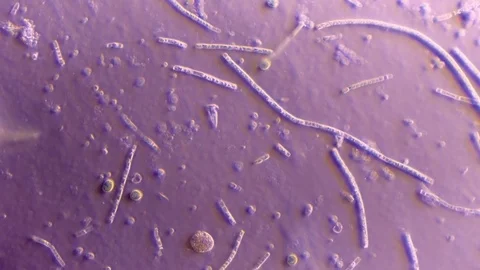 Bacteria & Protozoa from Lake Bed Time L... | Stock Video | Pond5