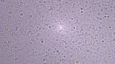 Bacteria Microscope Stock Footage ~ Royalty Free Stock Videos | Pond5