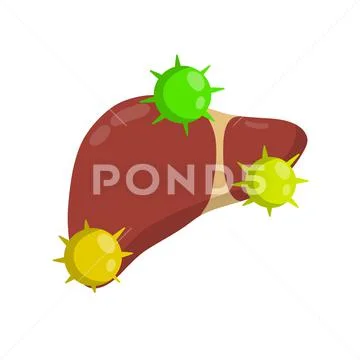 Bad liver. Attack germs and cirrhosis of the liver. Health problem ...
