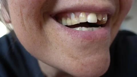 Bad tooth condition in smiling female mo... | Stock Video | Pond5