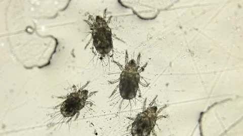 a barn or flour mite under a microscope | Stock Video | Pond5