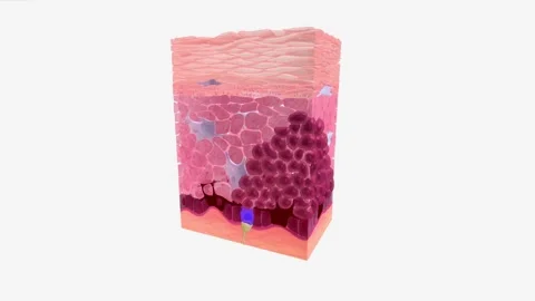 Basal Cell Carcinoma in Tissue Stage 0 | Stock Video | Pond5