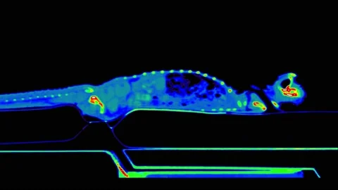 Ct Scan Isolated Stock Footage ~ Royalty Free Stock Videos | Pond5