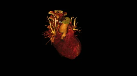 Ct Scan Heart Stock Footage ~ Royalty Free Stock Videos | Pond5