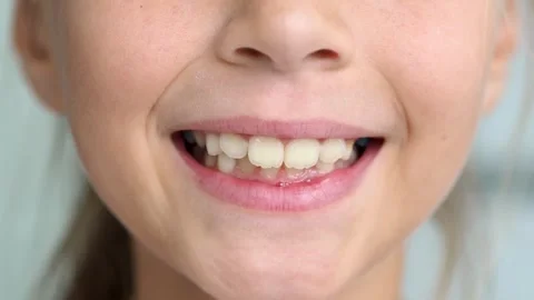 Attractive Teeth Illustration Stock Videos – Royalty-Free HD & 4K Videos