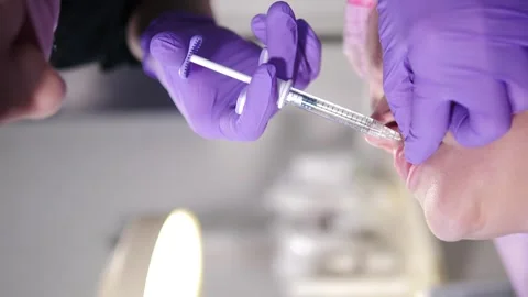 Beauty injections. Lip injection plastic... | Stock Video | Pond5