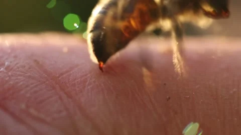 Bee sting trying to remove from the huma... | Stock Video | Pond5
