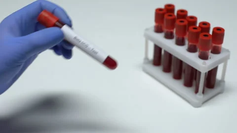 Beta hCG test, doctor showing blood samp... | Stock Video | Pond5