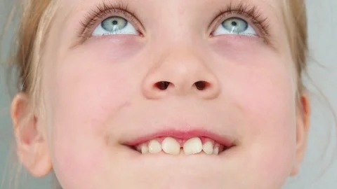 Bite your lower lip. Children's jaw and ... | Stock Video | Pond5