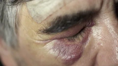 black eyes of middle age boxer after fig... | Stock Video | Pond5