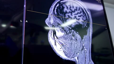 Black Head Nurses Stock Videos – Royalty-Free HD & 4K Videos