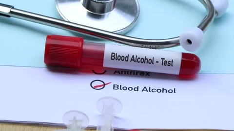 Blood Alcohol test to look for abnormali... | Stock Video | Pond5