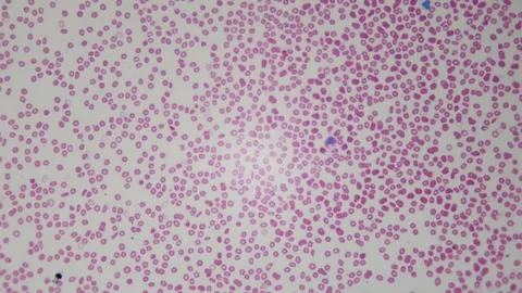 Blood And Blood Types Under The Microscope Youtube