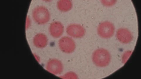 Cancer Cells Under Microscope Stock Footage ~ Royalty Free Stock Videos ...