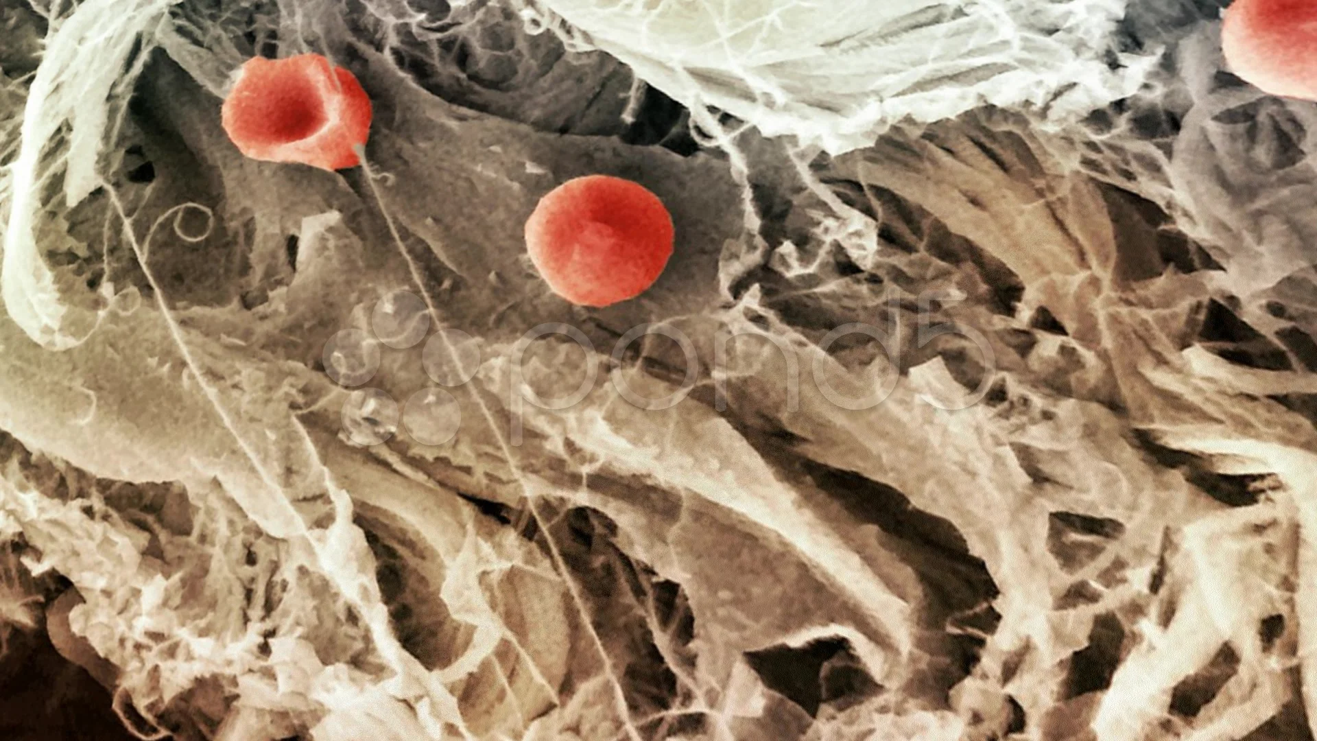 Color Scanning Electron Micrograph Of A Blood Clot The Red Blood Cells