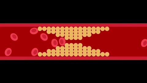Blood clots. 2D Animation. | Stock Video | Pond5