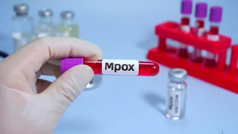Blood collection tubes Mpox test positiv... | Stock Video | Pond5