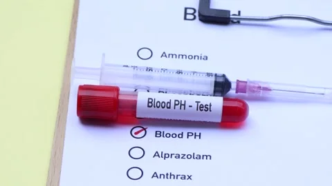 Blood pH test to look for abnormalities ... | Stock Video | Pond5