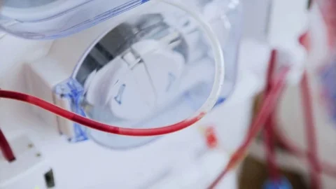 Blood Purification Medical Procedure - P... | Stock Video | Pond5