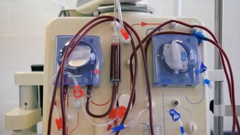 Blood purification procedure. Hardware H... | Stock Video | Pond5