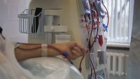 Blood purification procedure. Hardware H... | Stock Video | Pond5